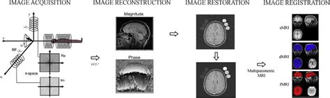 Deep Learning In The Mr Signal Processing Chain From Image Acquisition Download Scientific