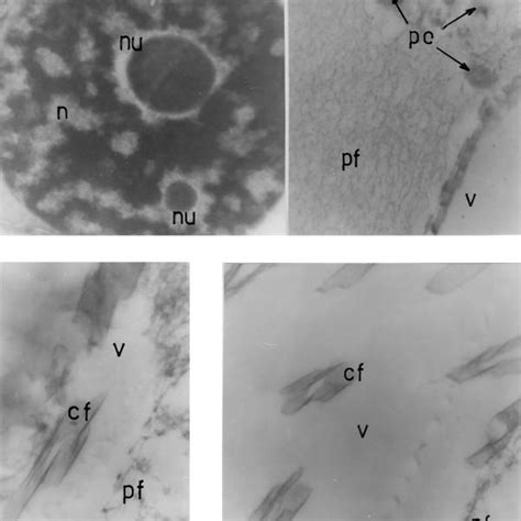 In The Root Tip Cells Of S Lutea Meristematic Cells And The Raphide Download Scientific