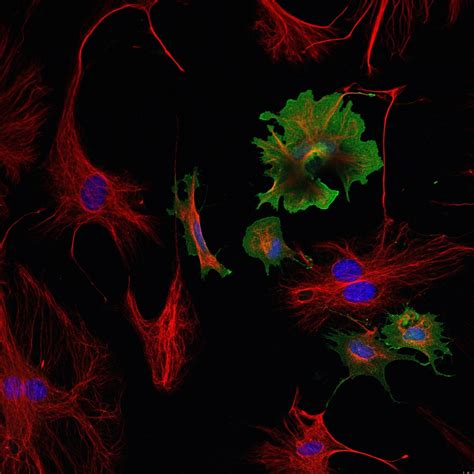 Imces Calendar Life Beyond Vision