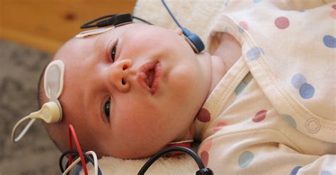 Interacoustics A S On Linkedin Beyond The Basics Threshold Abr