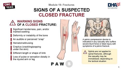 Open Vs Closed Fracture General Trauma Management Of Polytrauma