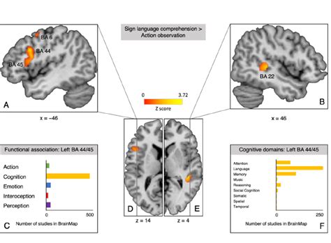 The Neural Basis Of Sign Language Processing In Deaf Signers An Activation Likelihood