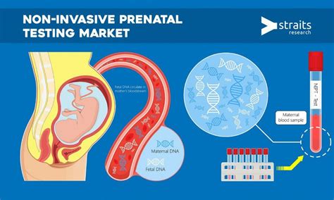 Non Invasive Prenatal Testing Market Continues To Grow As Demand For