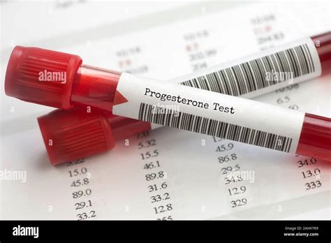 Progesterone Hormone Test Hi Res Stock Photography And Images Alamy