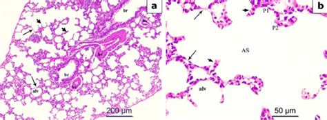 Photomicrographs Of The Rat Lung Tissue Of The Control Group Showing Download Scientific