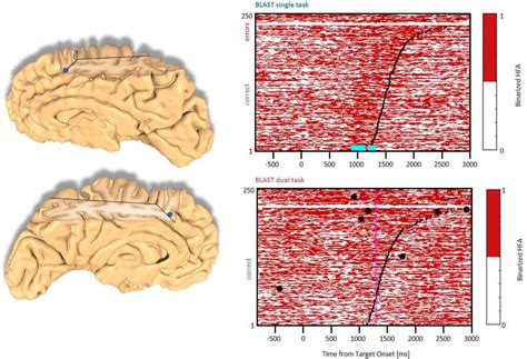 Interference In The Anterior Cingulate Cortex And The Pre Supplementary