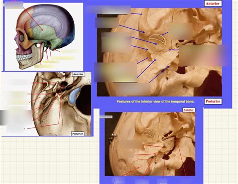 Temporal Bone Diagram Quizlet