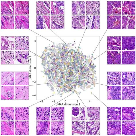 Uniform Manifold Approximation And Projection Umap Representation Of