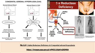 Sex Reversal Pdf Hormonal Disorders Endocrine And Metabolic Diseases