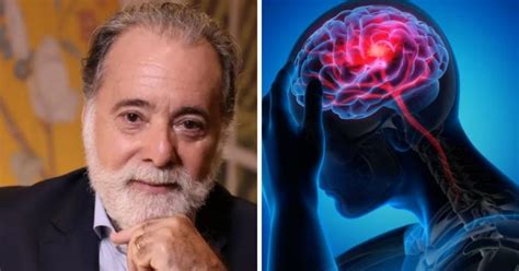 Hemorragia Cerebral O Que é Sintomas Riscos E Tratamento Da Doença