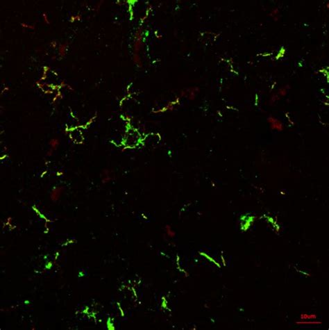 Investigating Sudep Through Brain Tissue Epilepsy Society