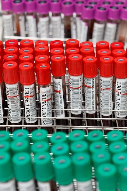 Premium Photo Blood tube for testing in labã ââ ratory