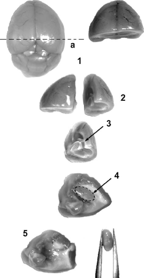Dissection Procedure See Text For Details Download Scientific Diagram