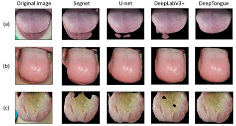 visual results of segmentation for tongue images a the segmentation