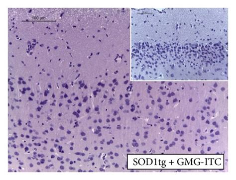 Inos Formation And Mmp 9 Expression Immunohistochemical Ihc