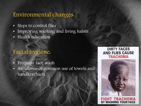 Trachoma Ppt