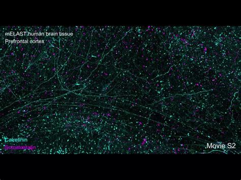 The Picower Institute For Learning And Memory On Linkedin Neuroscience Brain Brainimaging