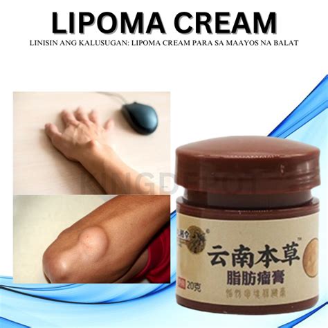 Lipoma Cream Original Lipoma Removal Cream Treat Tumor Skin Swelling