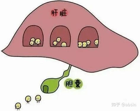 多色文献解读肝胆多同病胆汁淤积型肝炎 知乎