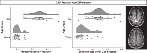 Higher Csf Fraction In Older Age Left Csf Fraction Within The Frontal Download Scientific