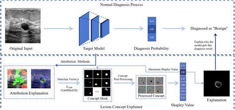 [논문 리뷰] Lce A Framework For Explainability Of Dnns For Ultrasound Image Based On Concept Discovery