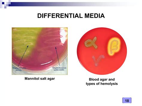 Medical Microbiology Laboratory Culture Media Classification Ppt