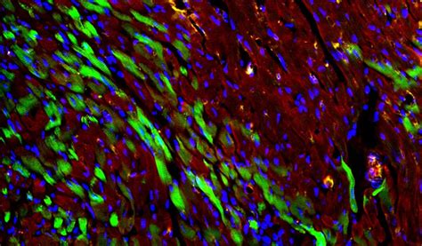 Pacemaker Researchers Swap Batteries For Biology Science Friday