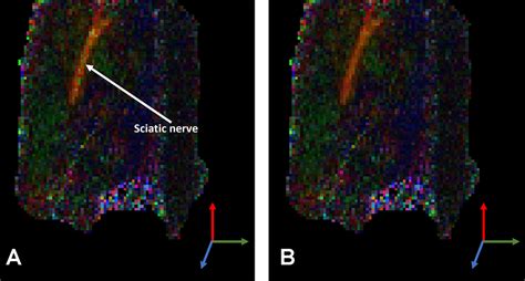 In Vivo Primary Eigenvector Rgb Component Colormaps Weighted By