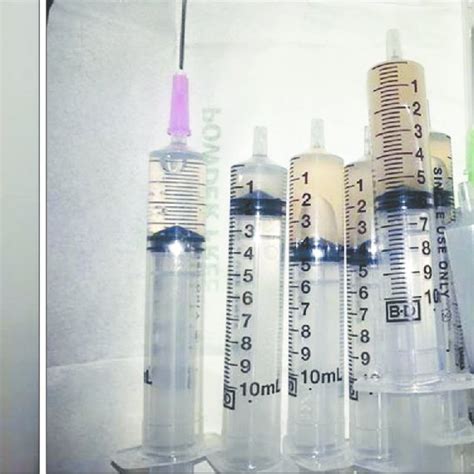 A An Anteroposterior Radiograph Of The Right Hip Showing An Amorphous Download Scientific