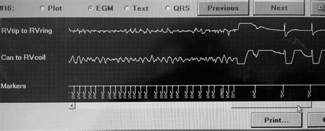 Succesful Dft Testing With 15j Download Scientific Diagram