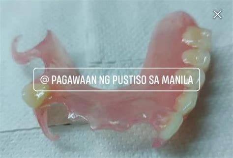 Pagawaan Ng Pustiso Sa Manila Manila