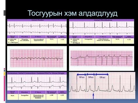 экг ятт б халиунаа