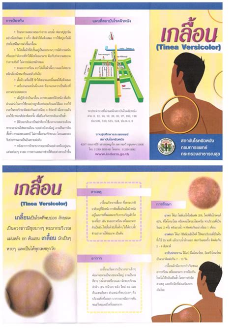 สถาบันโรคผิวหนัง กรมการแพทย์