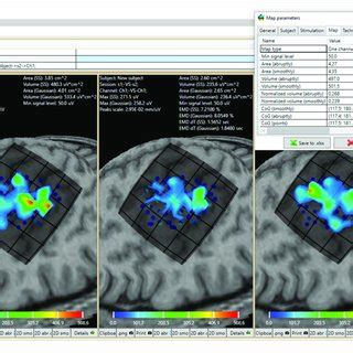 PDF TMSmap Software For Quantitative Analysis Of TMS Mapping Results