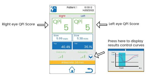 Idmed Digiscan Portable Video Pupillometer And Algesimeter User Manual