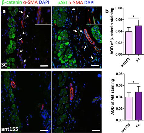 Topical Antagomir 155 Regulated Wntβ Catenin And Akt Signaling