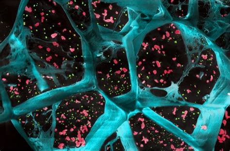 Biodegradable Hydrogel Boosts Immune Systems Attack On Several Cancers In Mice Bionews Central