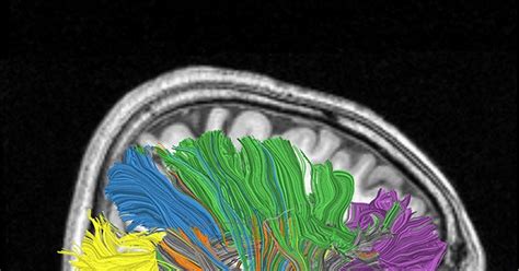 Reverse Engineering Of Human Brain Likely By 2030 Expert Predicts Wired