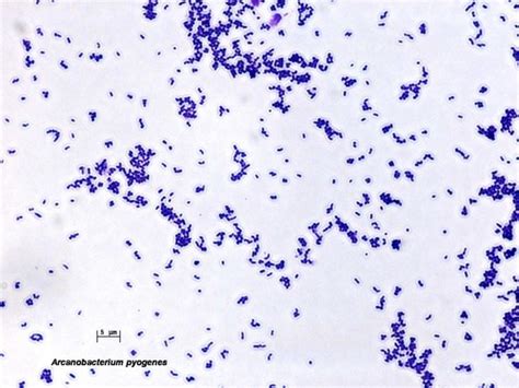 Actinomyces Pyogenes