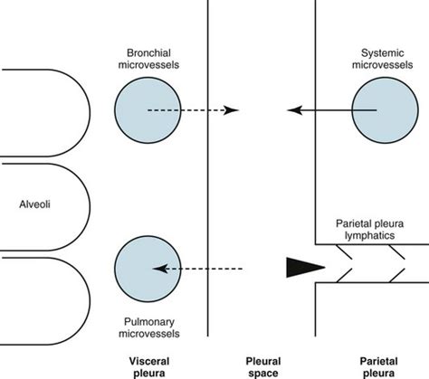 Pleural Disease Clinical Gateclinical Gate
