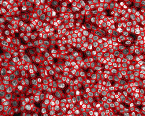 How The Cells `cell` And `membrane` Measurement Calculated For Staining With High Overlapped