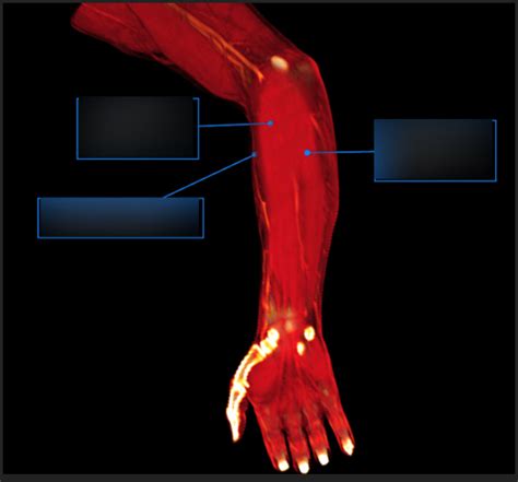 Module 6 Part 6 Diagram Quizlet