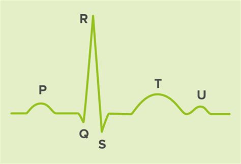 How To Interpret The ECG