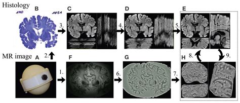 Framework Of The Mri Guided Histology Reconstruction 1 Mri
