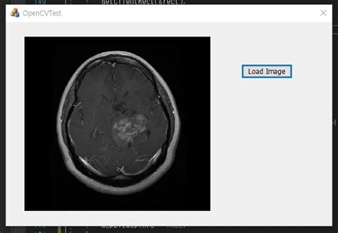 Mfc Dialog에 Image Load