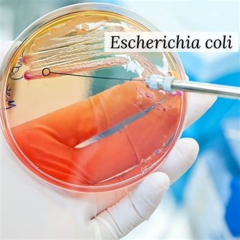 Escherichia Coli Todo Lo Que Necesita Saber Dimann