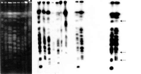 Chromosomal Localization Of Telomere Associated Sequences Download Scientific Diagram