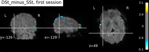 Example Of Explicit Fixed Effects Fmri Model Fitting Nilearn