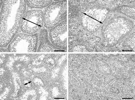 Testicular Morphology Of The Roosters Affected By Lithiasis A Some Download Scientific