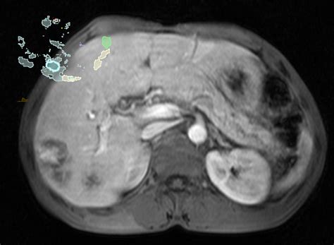 The Shape Of The Generated Label Does Not Match The Original Image · Issue 1 · Mrgiovanni